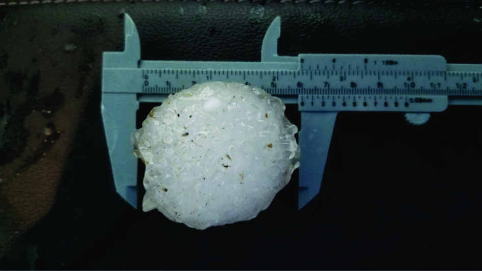 What Causes Hail - Part 3 - WeatherSolve Structures